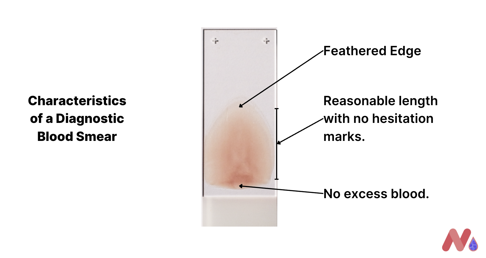 How to Perform a High-Quality Blood Smear — Moichor